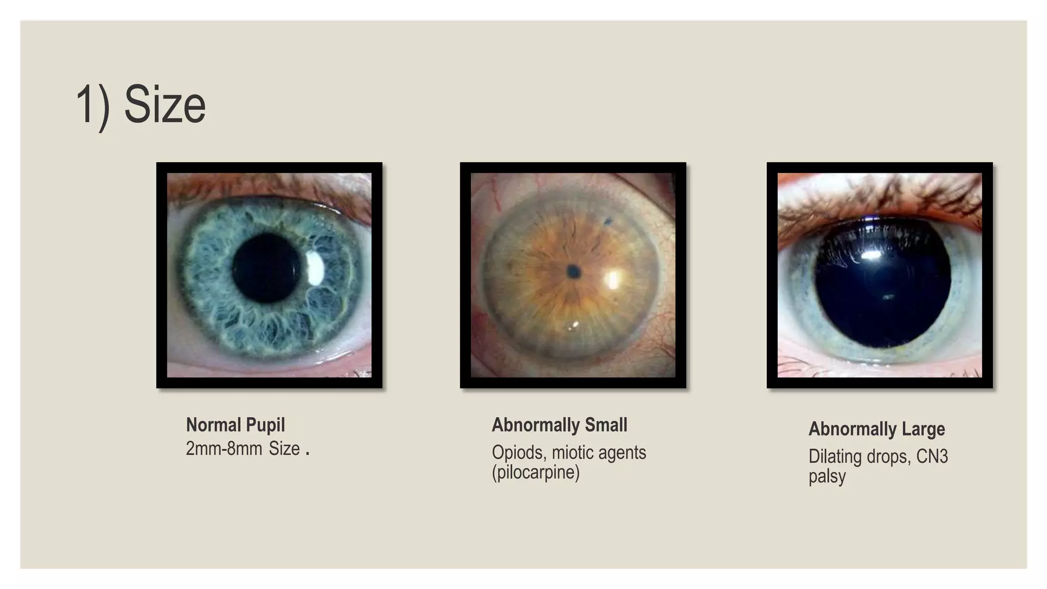 Pupil examination | PPTX