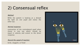 Pupil examination | PPTX