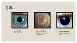 Pupil examination | PPTX
