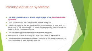 Pupillart management | PPTX