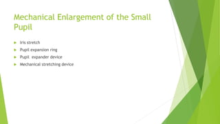 Pupillart management | PPTX