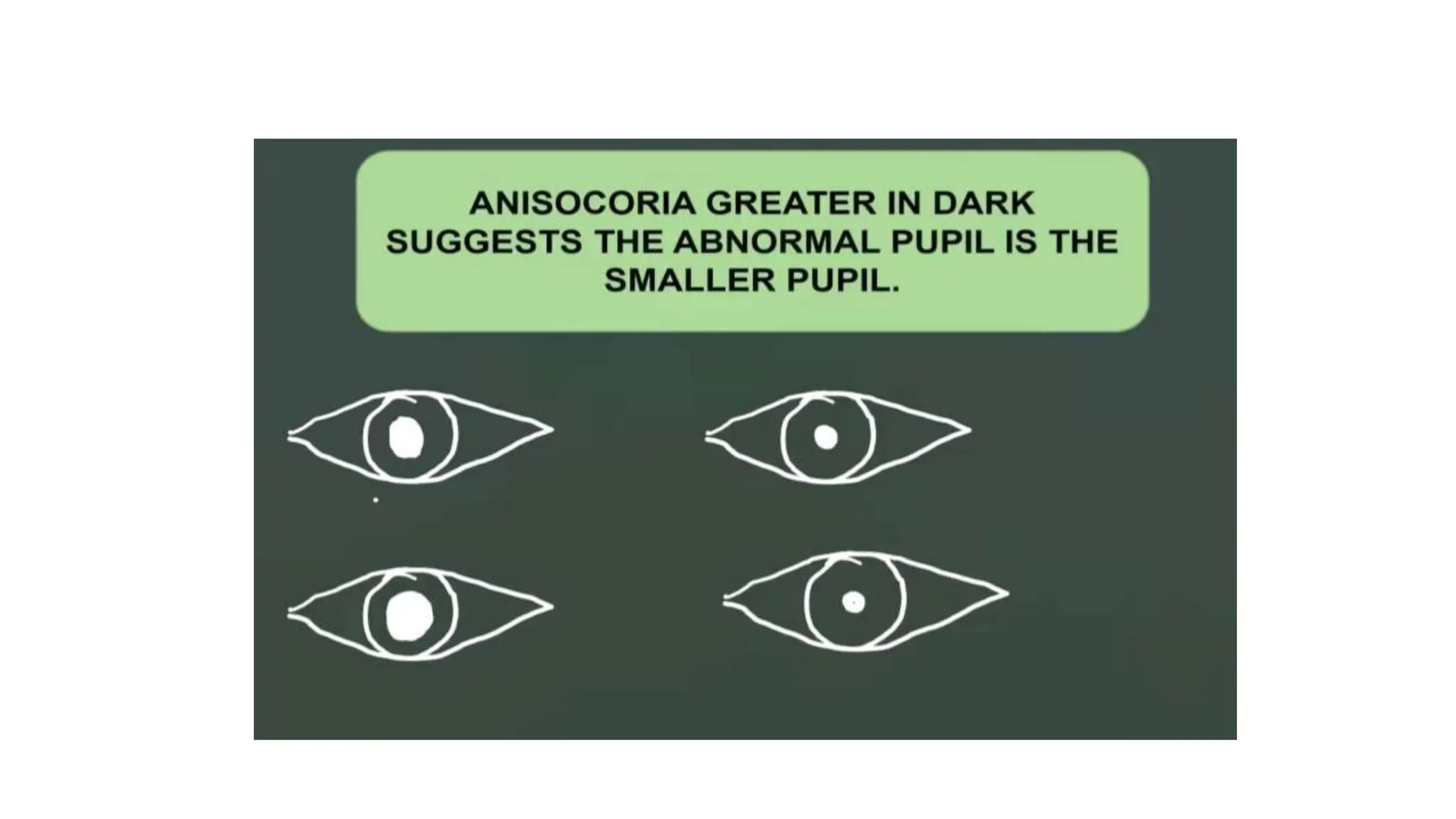 PUPILLARY ABNORMALITIES and pupillary reflexes | PPTX