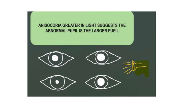 PUPILLARY ABNORMALITIES and pupillary reflexes | PPTX