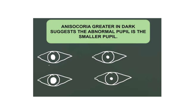 PUPILLARY ABNORMALITIES and pupillary reflexes | PPTX
