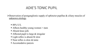 PUPILLARY ABNORMALITIES and pupillary reflexes | PPTX