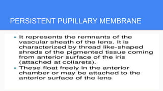 Partial Persistent Pupillary Membrane