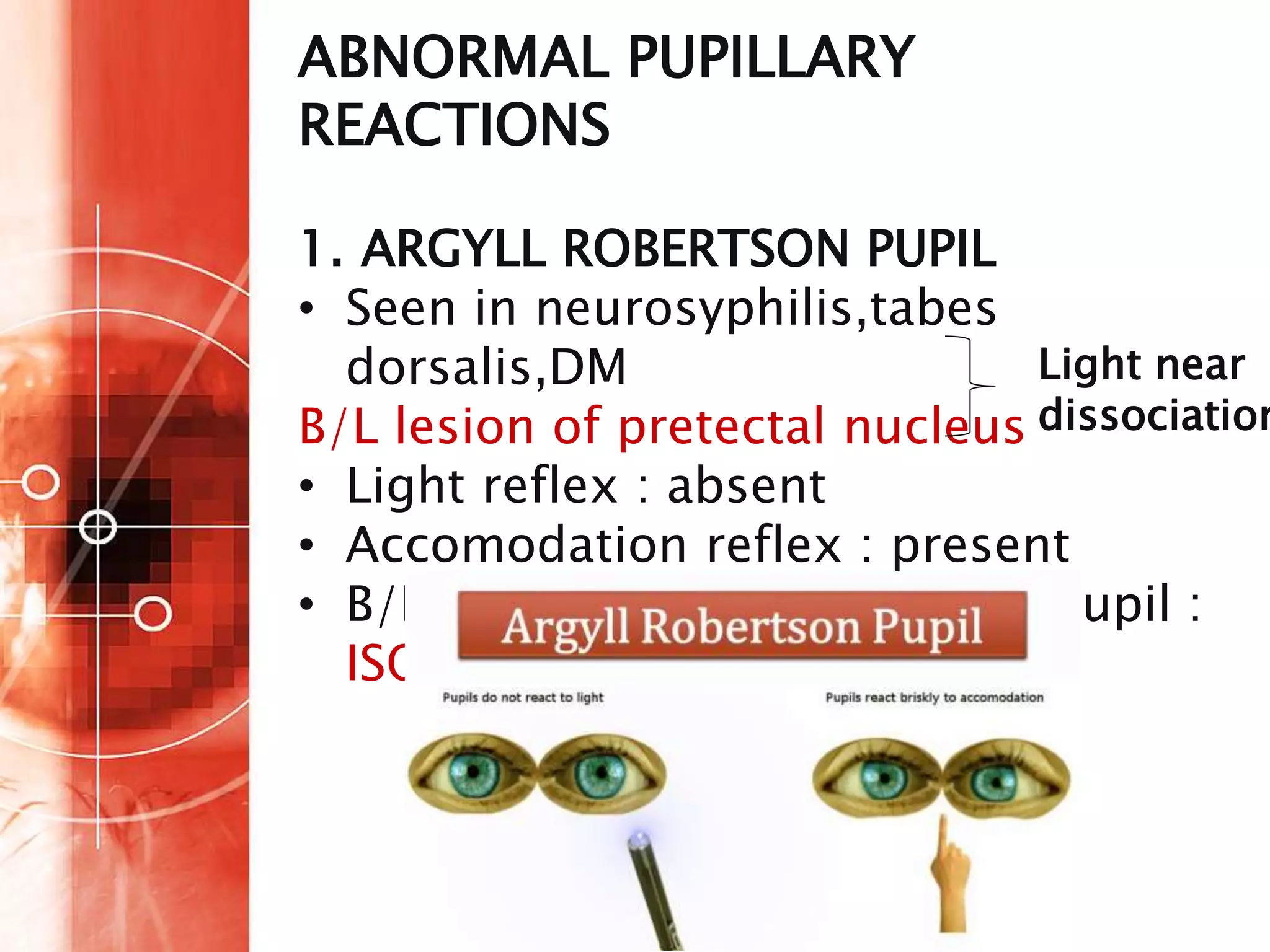 Pupillary and visual pathway | PPTX
