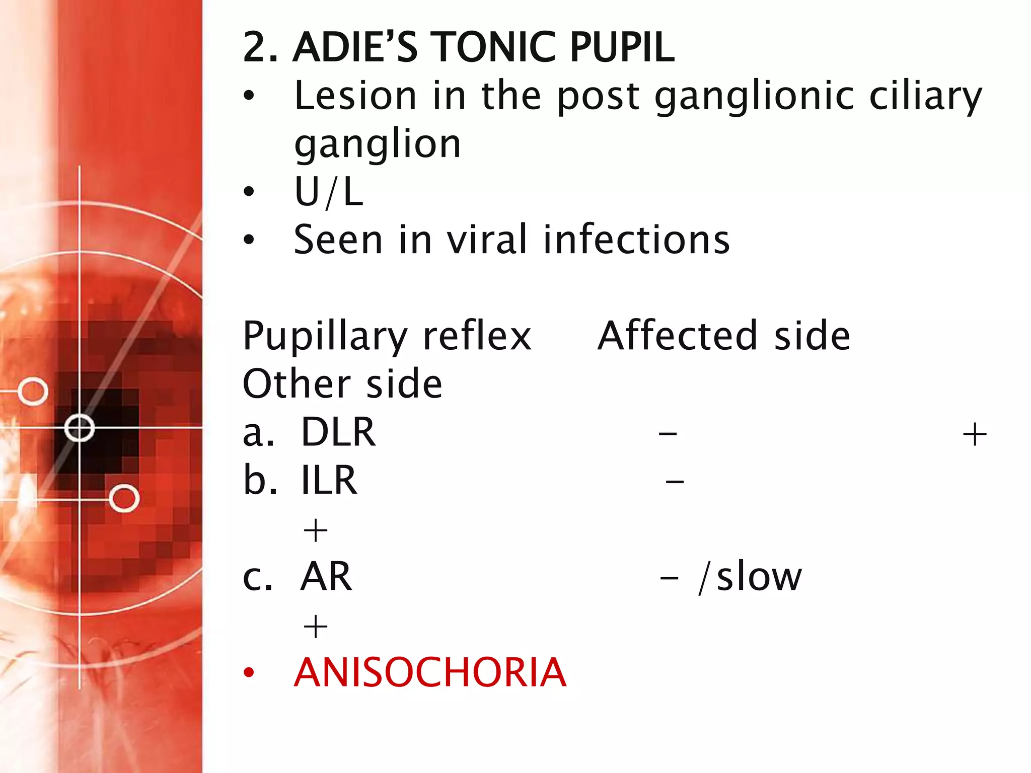 Pupillary and visual pathway | PPTX