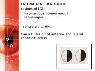 Pupillary and visual pathway | PPTX