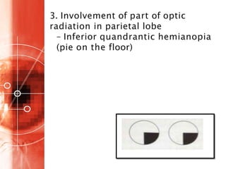 Pupillary and visual pathway | PPTX