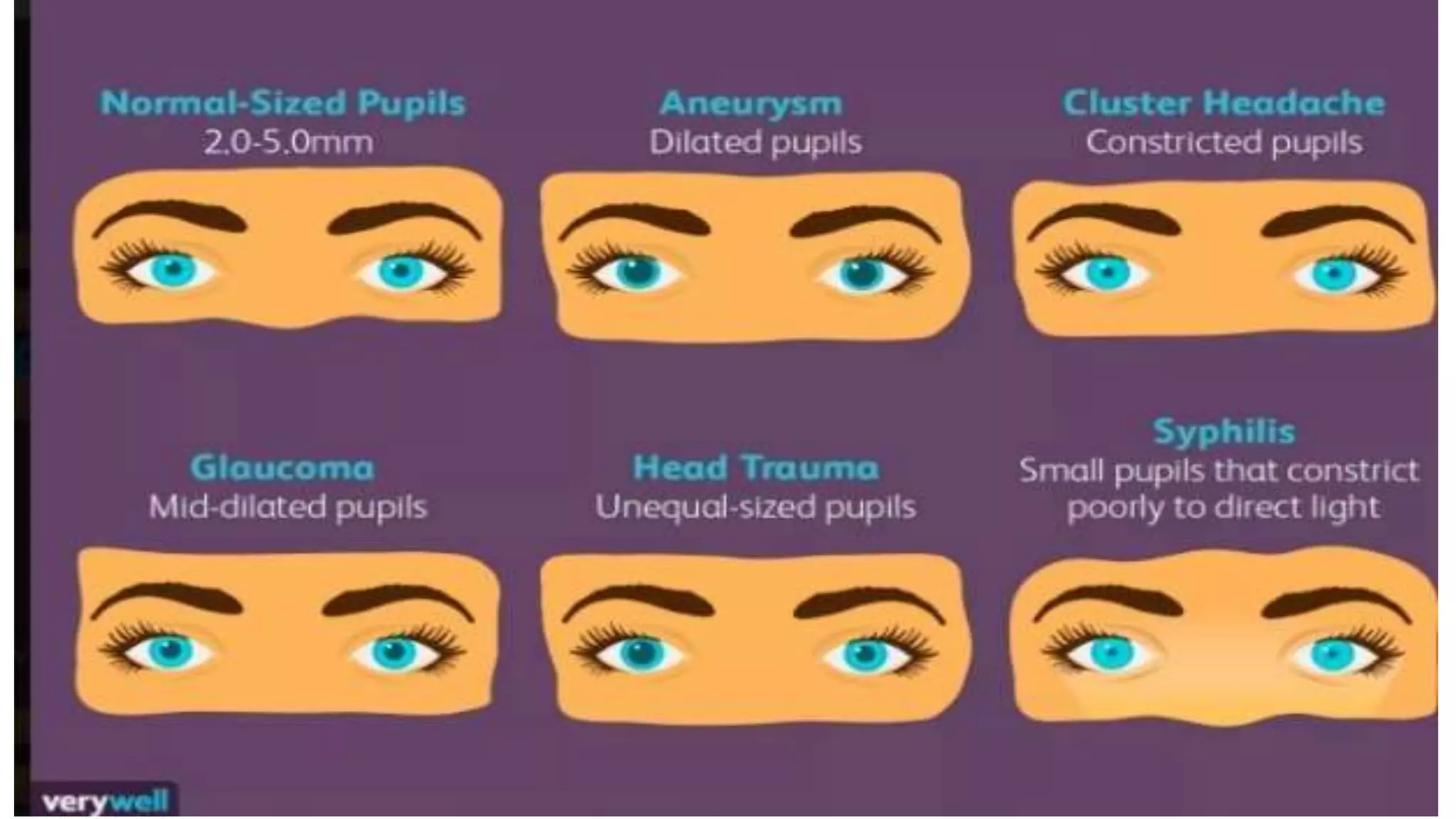 Pupillary assessment in coma patients clinical teaching | PPTX