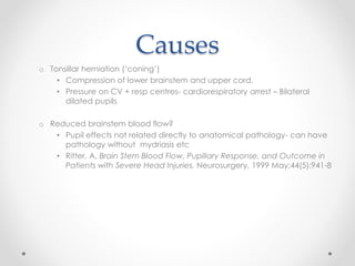 Pupillary dilatation in head injury | PPTX
