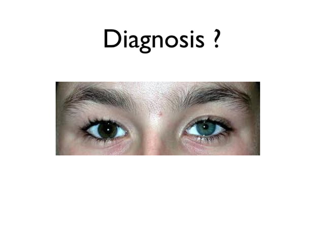 Pupillary disorders | PPT