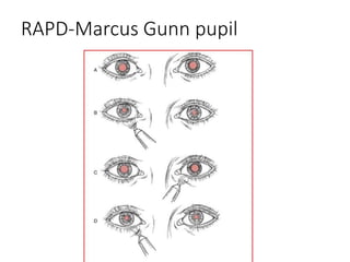 Pupillary pathway | PPTX