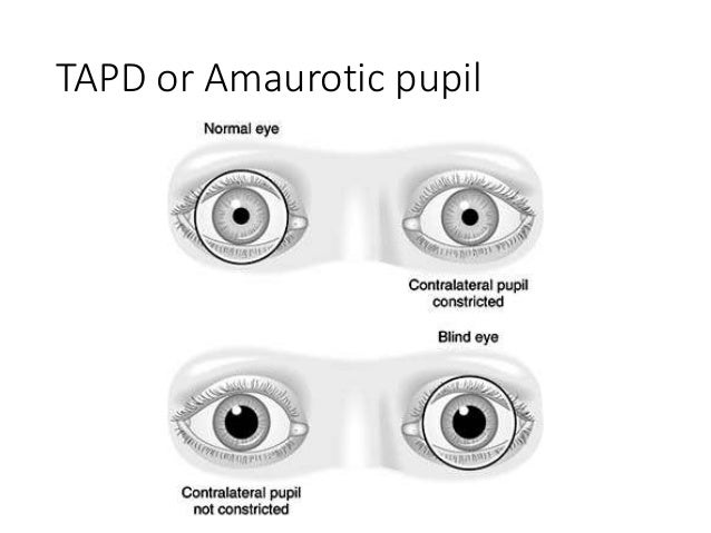 Pupillary pathway