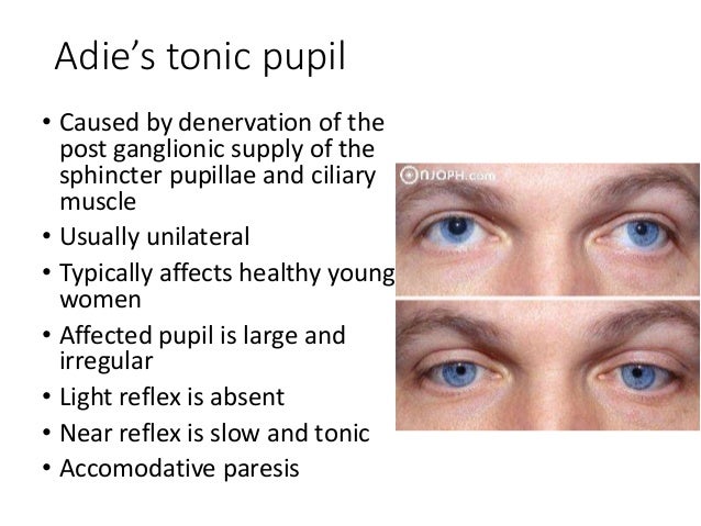 Pupillary pathway