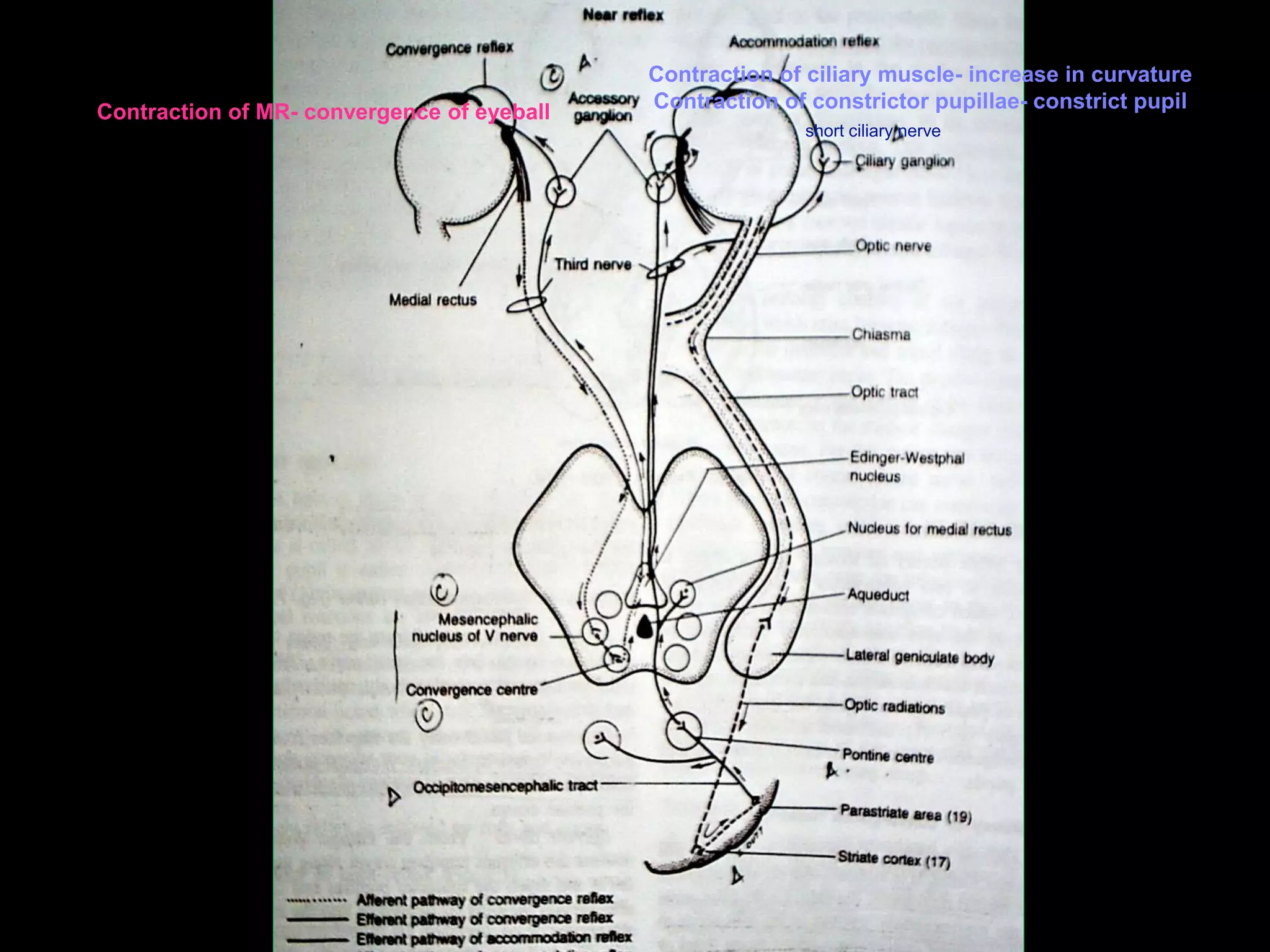 Pupillary pathway and its abnormality. | PPTX