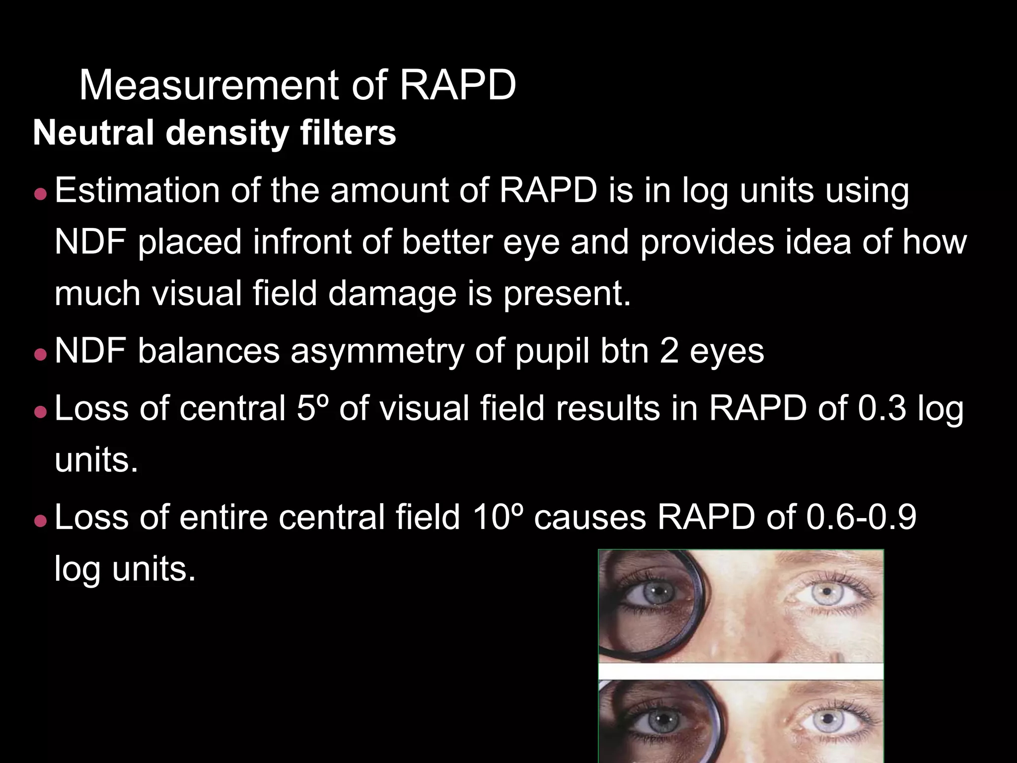 Pupillary pathway and its abnormality. | PPTX