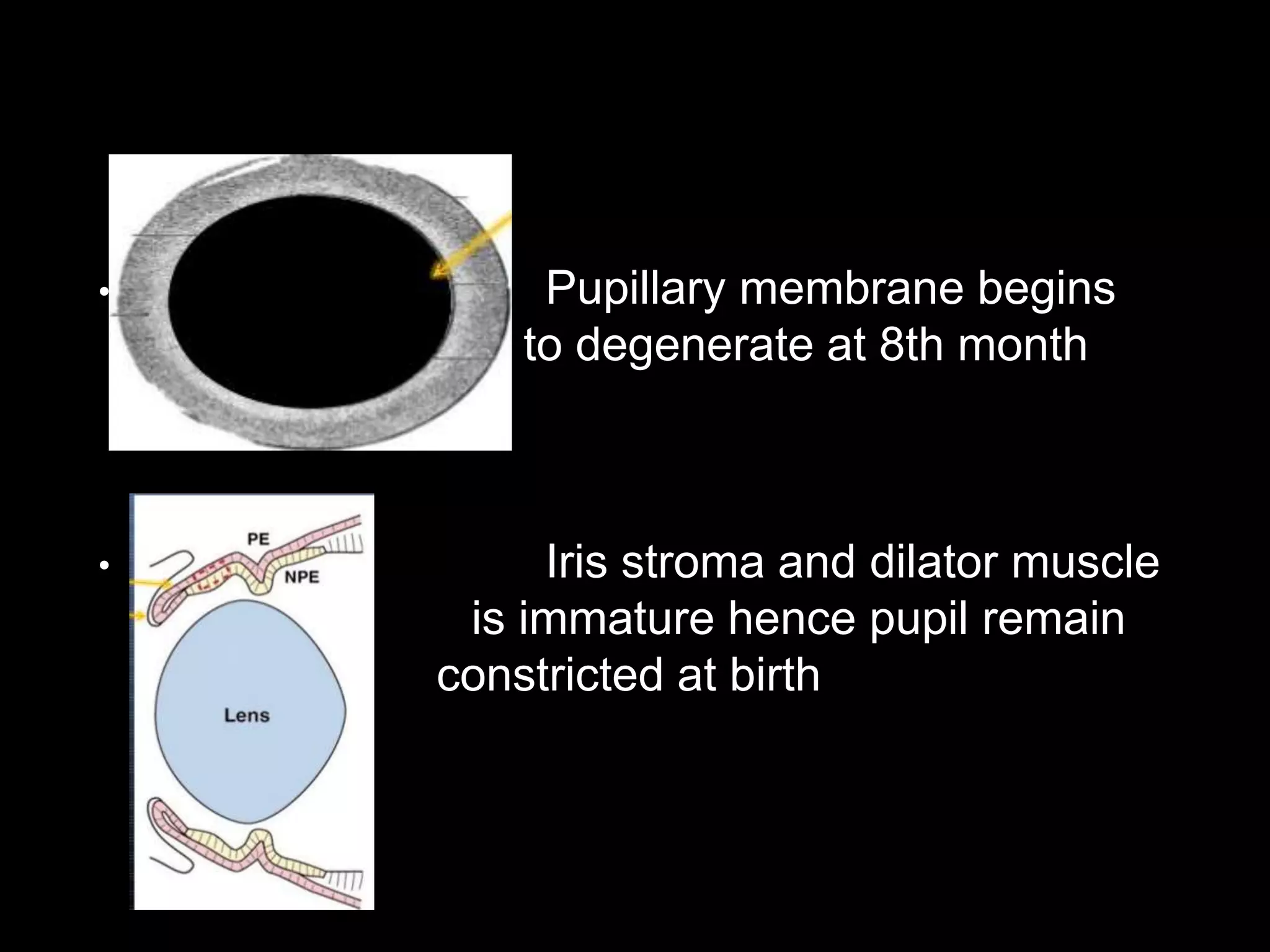 Pupillary pathway and its abnormality. | PPTX