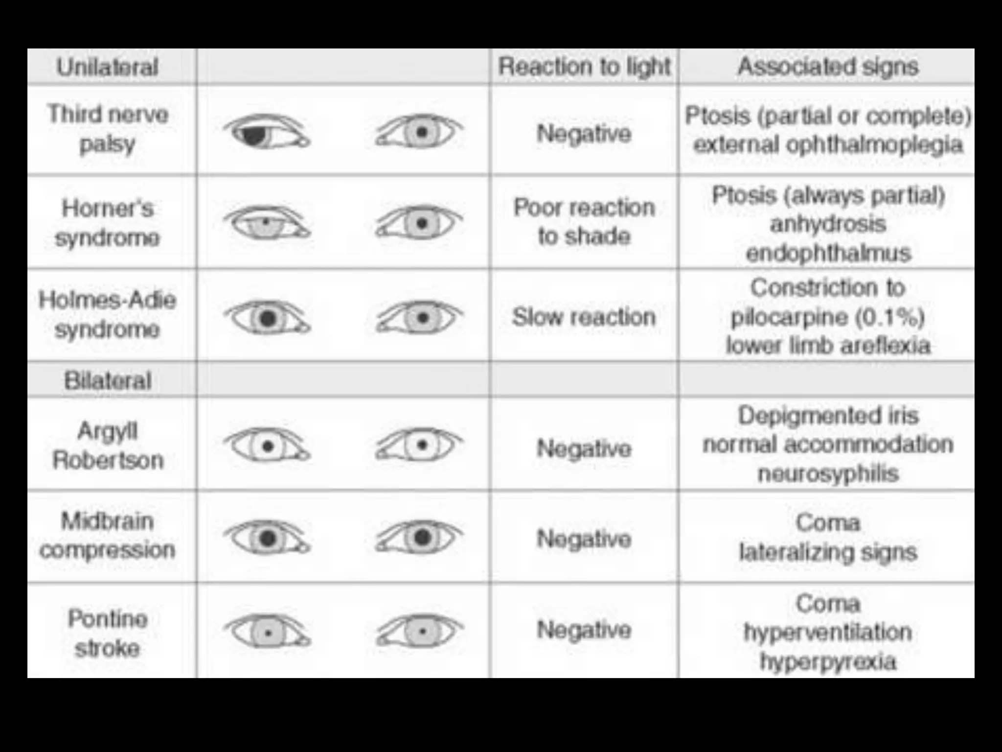 Pupillary pathway and its abnormality. | PPTX