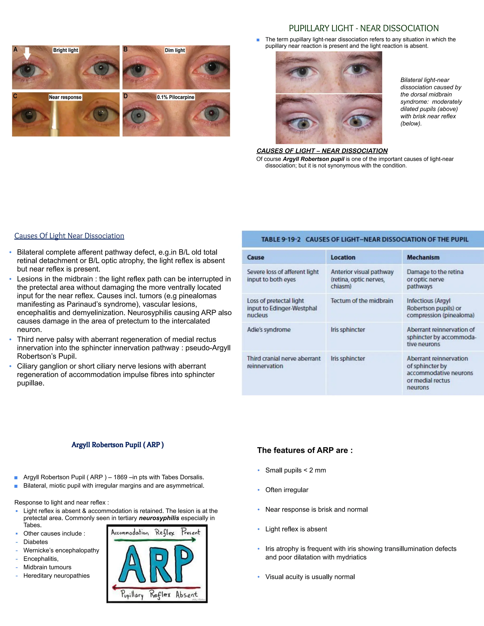 Pupillary pathway disorders. afferent efferent | PDF | Eye and Vision ...