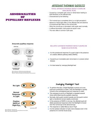 Pupillary pathway disorders. afferent efferent | PDF | Eye and Vision ...
