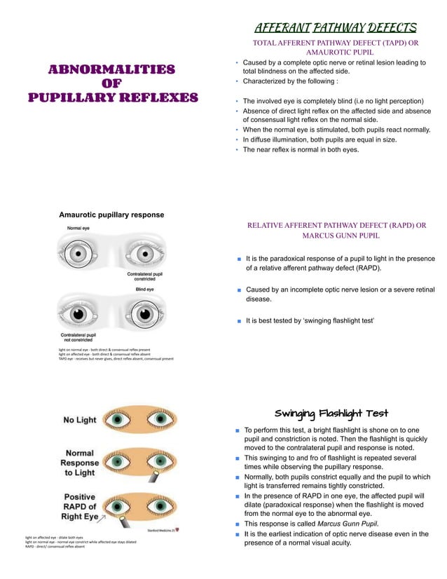 Pupillary pathway disorders. afferent efferent | PDF | Eye and Vision ...