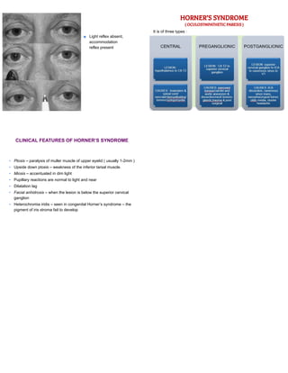 Pupillary pathway disorders. afferent efferent | PDF | Eye and Vision ...