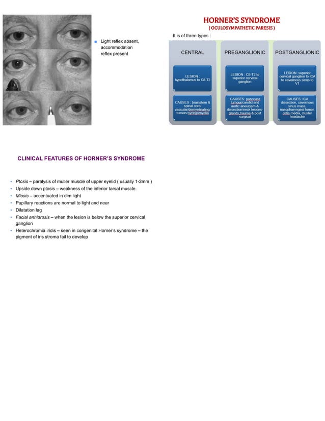 Pupillary pathway disorders. afferent efferent | PDF | Eye and Vision ...