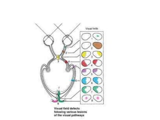 Pupillary pathway & field defects dr.k.srikanth-25.05.16