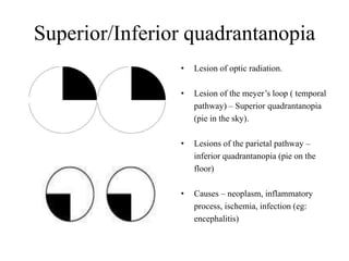 Pupillary pathway & field defects dr.k.srikanth-25.05.16