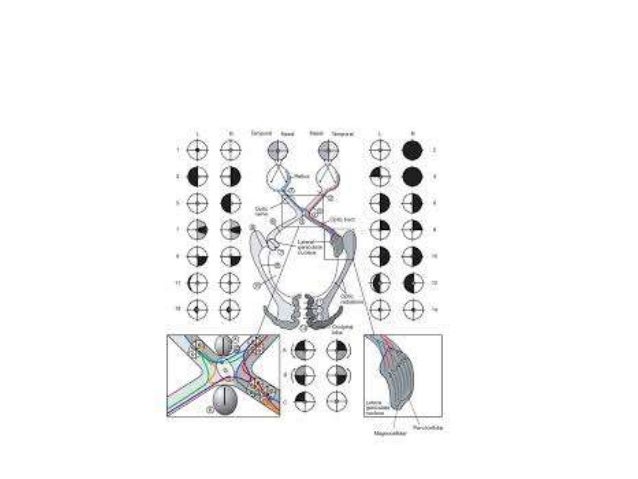 Quadrantanopsia Meaning