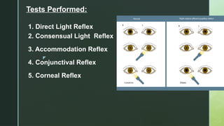 intoductionofPupillaryreflexneuroanatomy.pptx