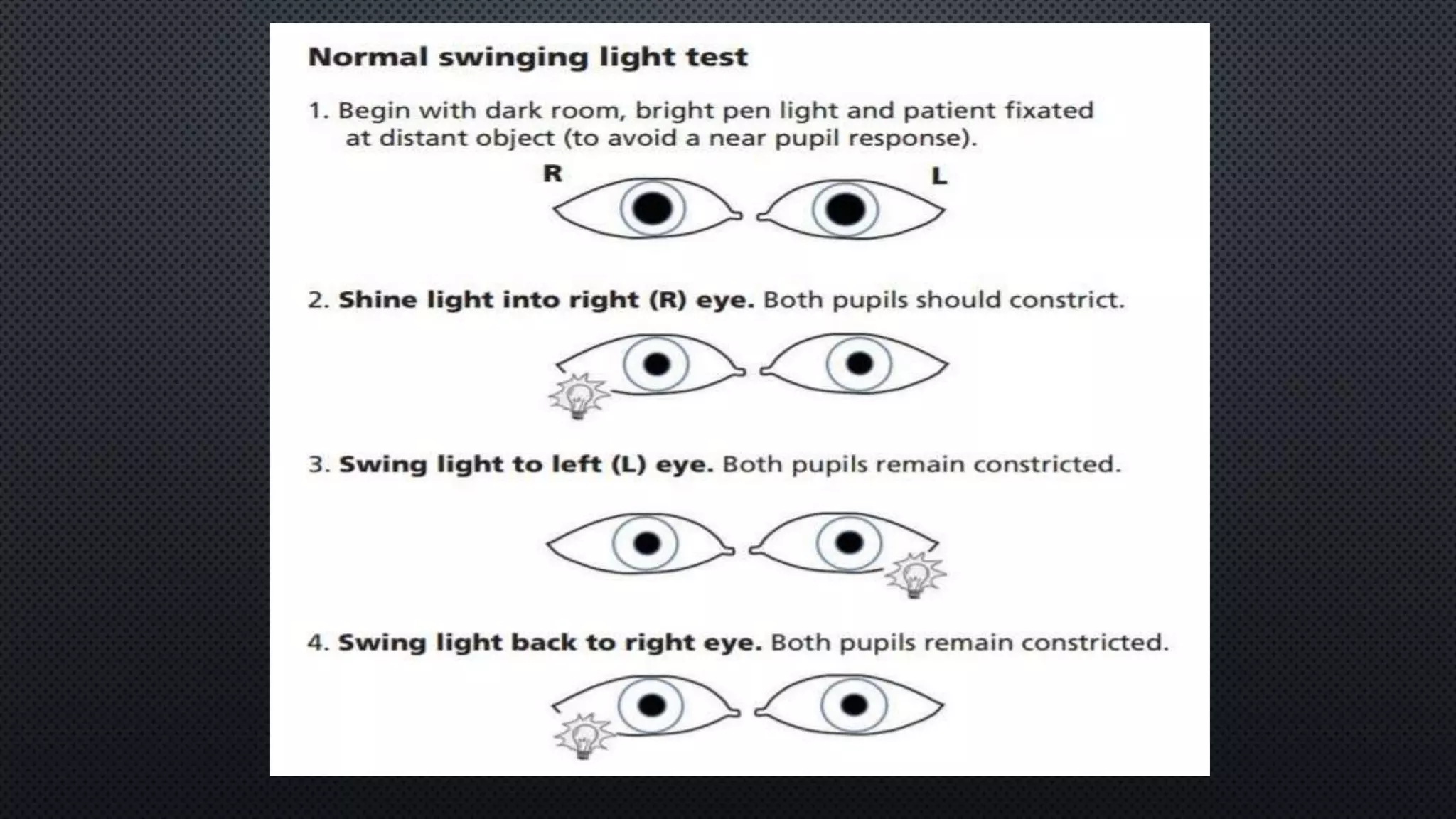 pupillary reflex ophthal.pptx