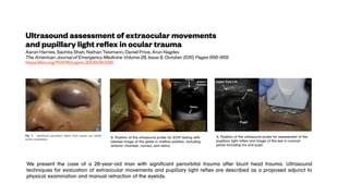 Pupillometry Through the Eyelids | PDF
