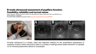 Pupillometry Through the Eyelids | PPT