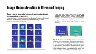Pupillometry Through the Eyelids | PDF