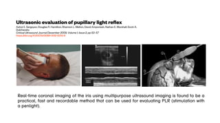 Pupillometry Through the Eyelids | PPT
