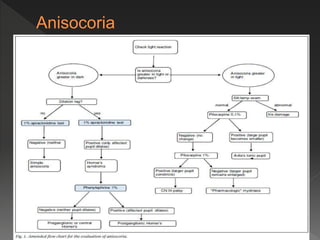 Anisocoria Flow Chart