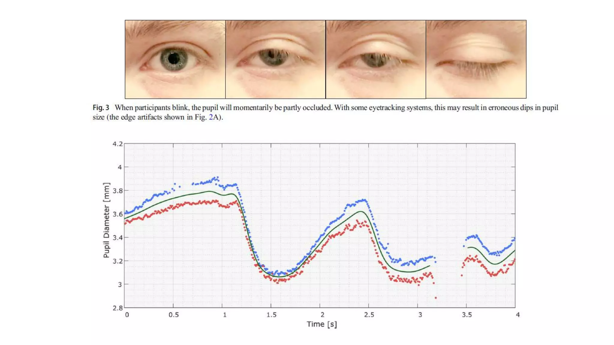 Pupillometry tutorial: from A to Z | PPTX