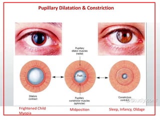 Pupils Neuroophthalmology Teaching Slides, Dr M D Mohire, Kolhapur ...