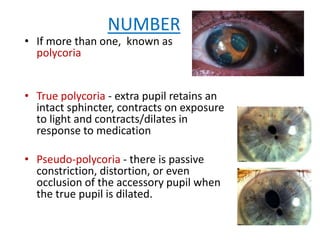 PUPIL Seminar final (3).pptx