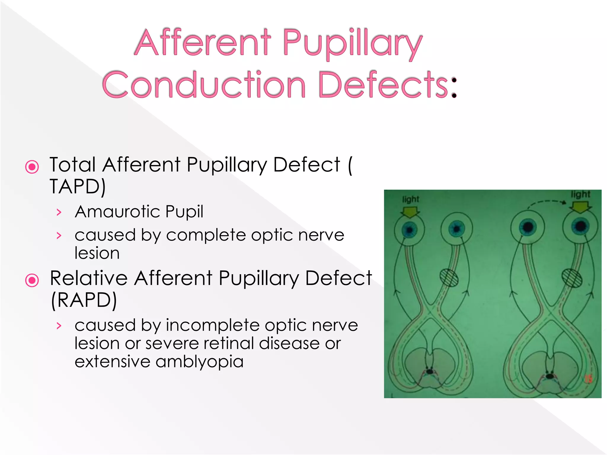 importance Of Pupil Examination | PDF