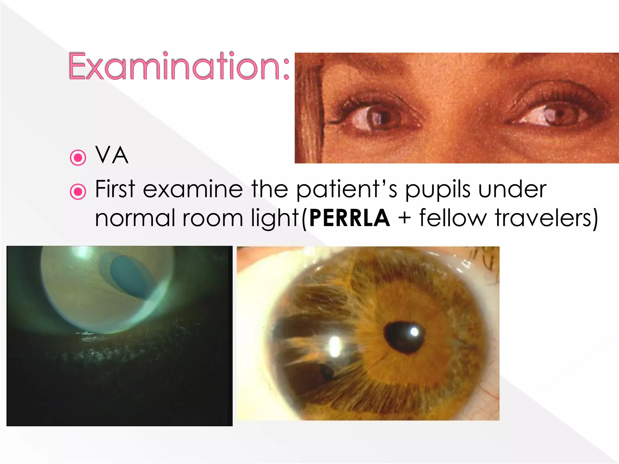 importance Of Pupil Examination | PDF