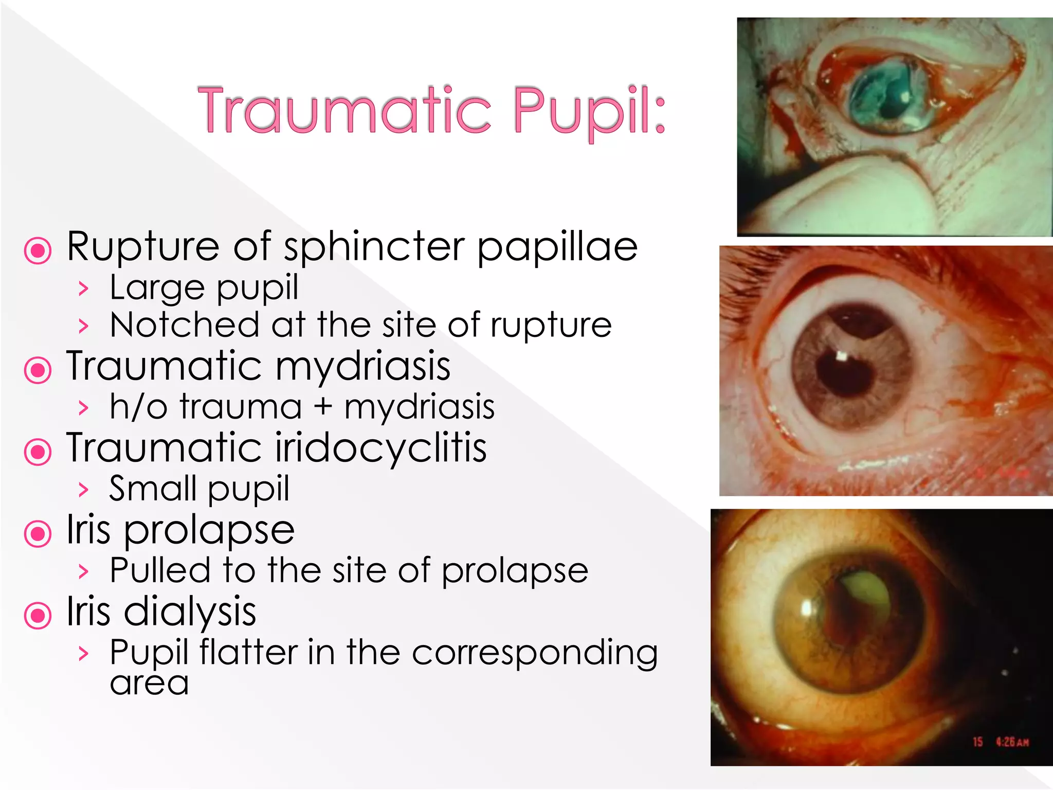 importance Of Pupil Examination | PDF
