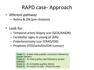 Pupil: Notes | PPT | Free Download
