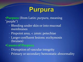 Pupura In A Patient With Lupus | PPT