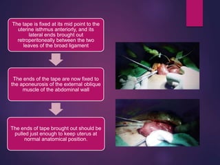 Purandares cervicopexy | PPTX