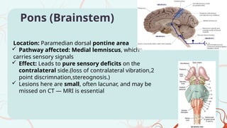 Pure Sensory Stroke (PSS) New theme (1).pptx