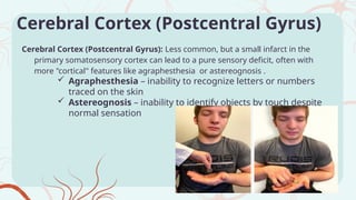 Pure Sensory Stroke (PSS) New theme (1).pptx